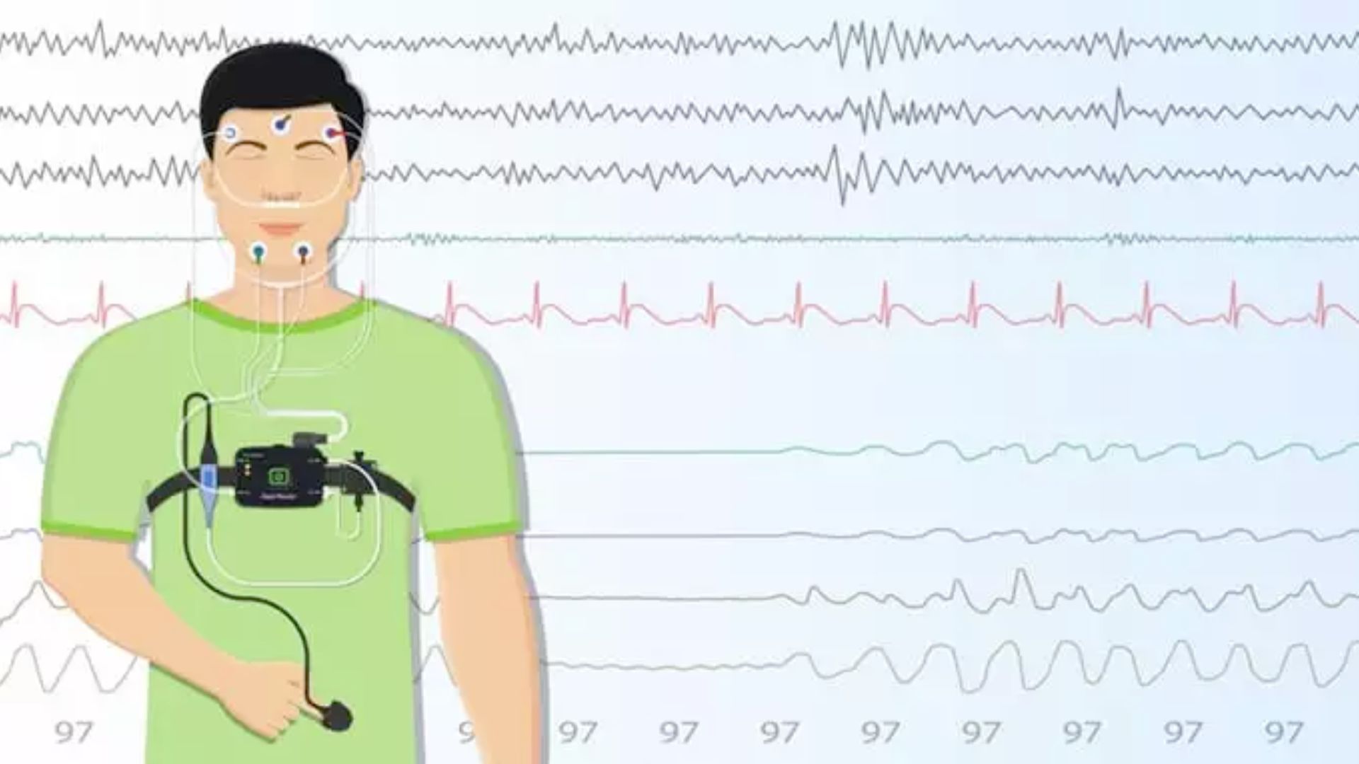 Polissonografia - Hemoclin - Campos - Agende Agora